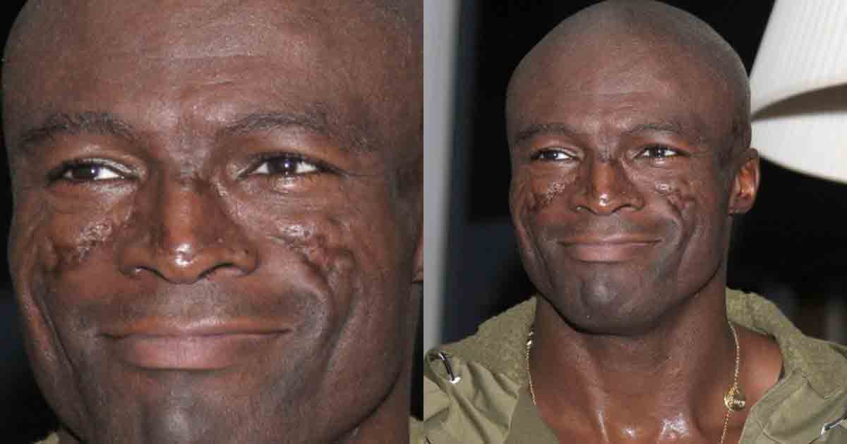 Seal’s iconic face scars explained—Why they’ve been with him for over ...
