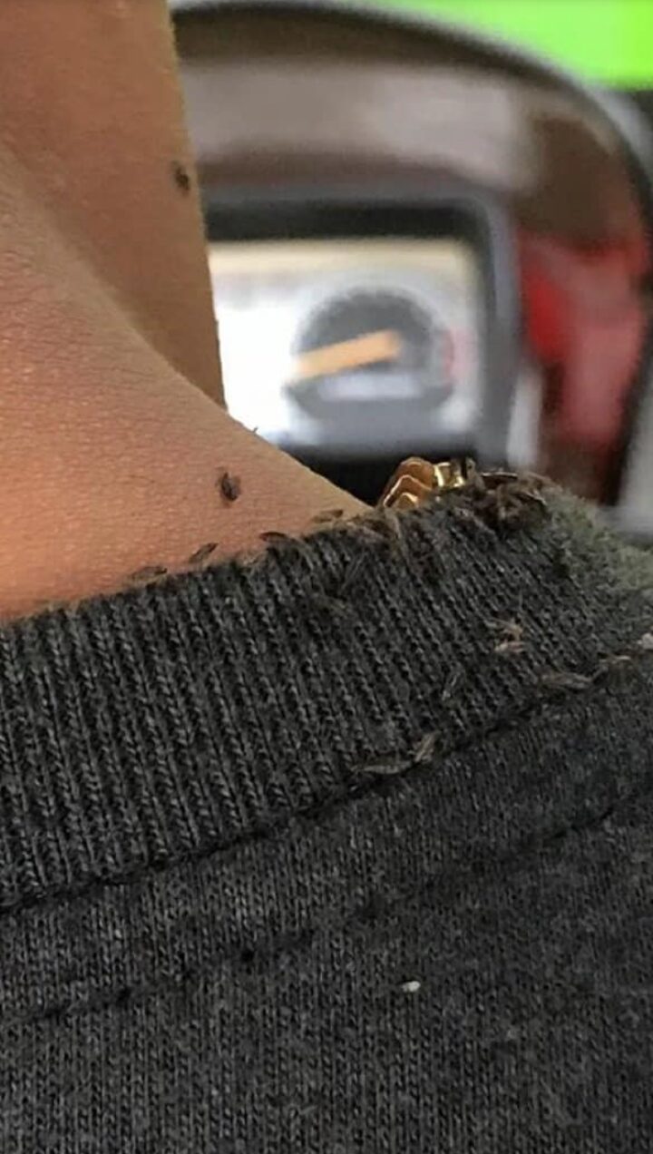 Man’s extreme head lice infestation goes viral, shocking the internet