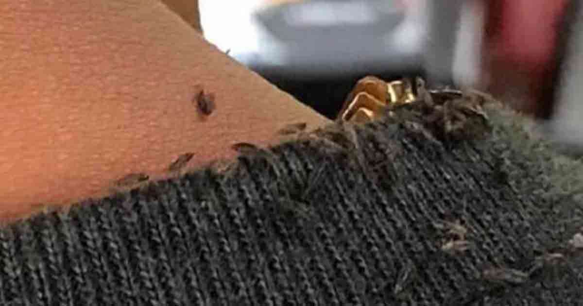 Man’s extreme head lice infestation goes viral, shocking the internet